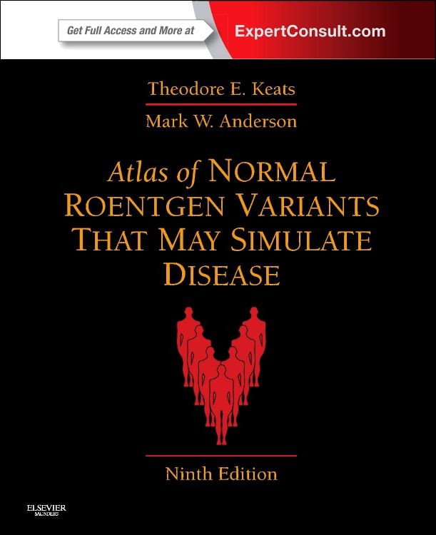 Atlas of Normal Roentgen Variants That May Simul: 9th edition ...