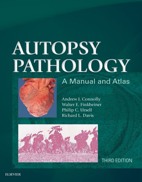 Autopsy Pathology A Manual And Atlas E Book 3rd Edition Andrew J
