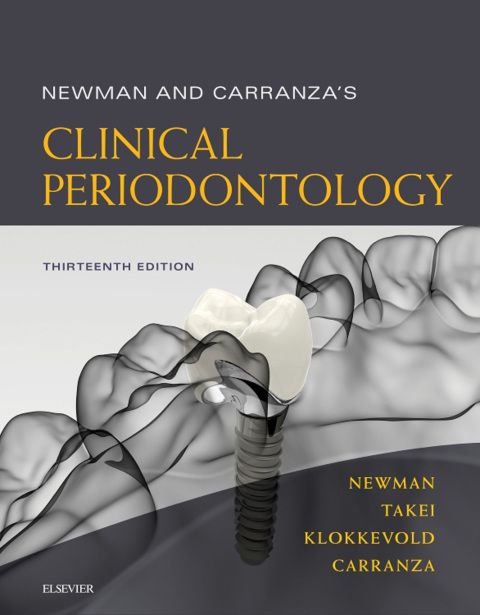 Newman and Carranza's Clinical Periodontology E-: 13th edition ...
